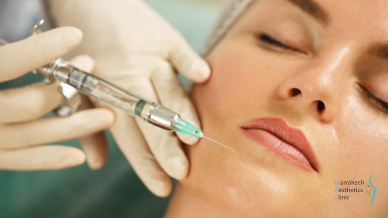Qu’est-ce que les injections de fillers